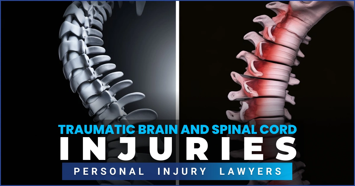 Brain and Spinal Cord Injury Lawyers | Makaronets Law